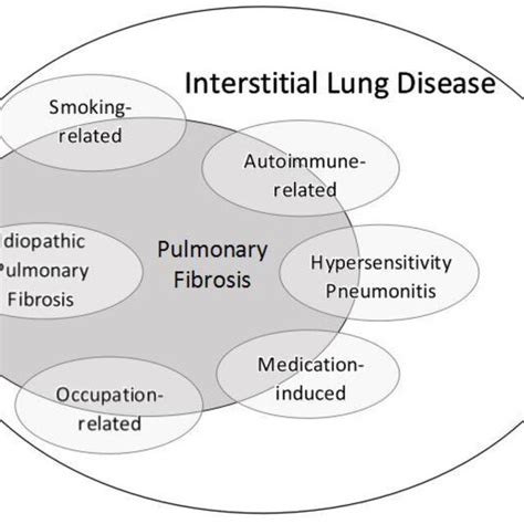 Schematic Overview Of Interstitial Lung Disease Ild And Pulmonary