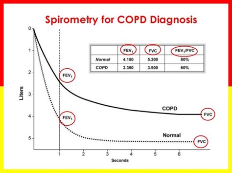 Diagnosis And Assessment Of Copd