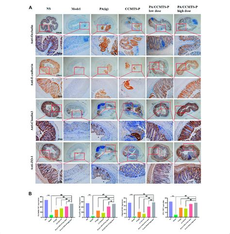 The Protective Effect Of Paccmts P On Intestinal Mucosal Barrier In Download Scientific