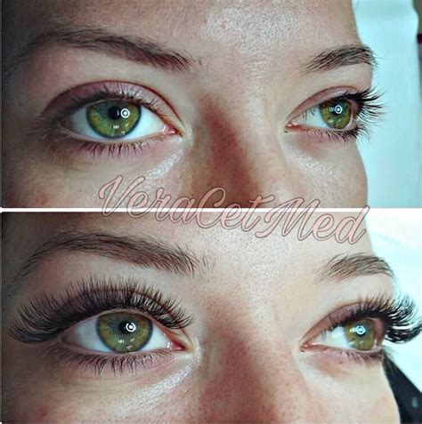 Център ЦитМед микроблейдинг 3d вежди и мигли косъм по косъм Материалите на ЦИТМЕД са