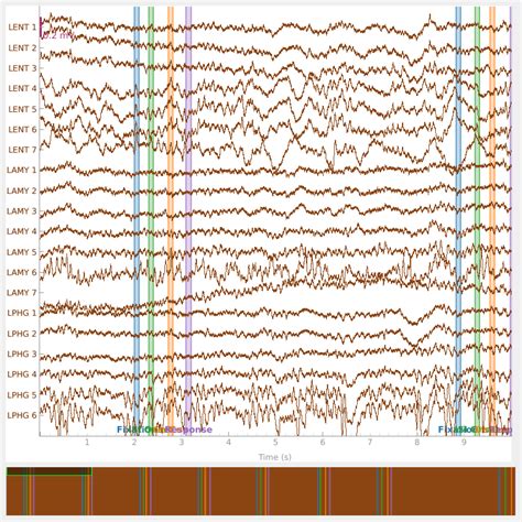 Pca Lda Decoding — Ieeg Pipelines 0 1 Documentation