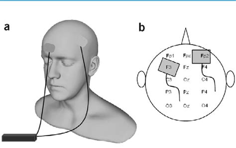 Transcranial Direct Current Stimulation Tdcs Of The Left Frontal Area Download Scientific