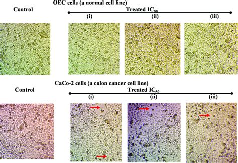 Representative Photomicrograph Of Oec And Caco 2 Cells Morphology After