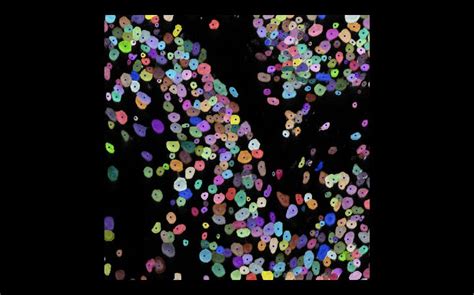 Nuclei Segmentation With Qupath Sam Plugin Usage And Issues Image Sc Forum