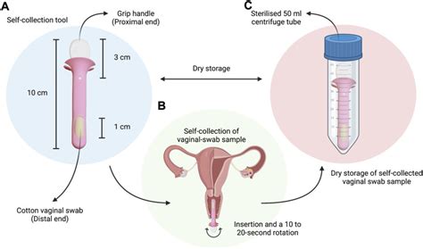 A Pilot Clinical Validation Study Of A Self Collected Vaginal Swab Device For The Detection Of