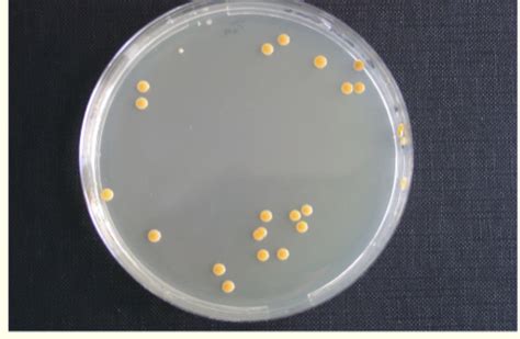 Enumeration Of Microorganisms Flashcards Quizlet