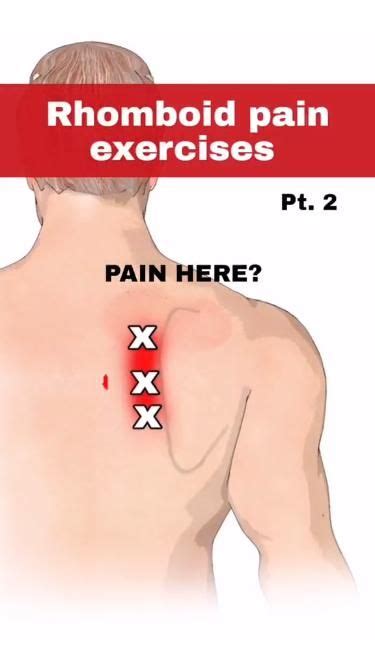 Say Goodbye To Rhomboid Pain With These Easy Exercises And Stretches Artofit
