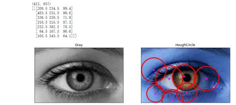 Opencv20：霍夫圆变换 Csdn博客