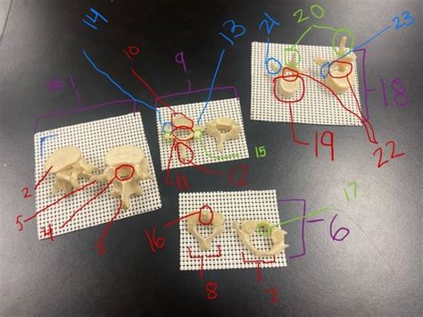 Lab Practical Labeling 1 Flashcards Quizlet