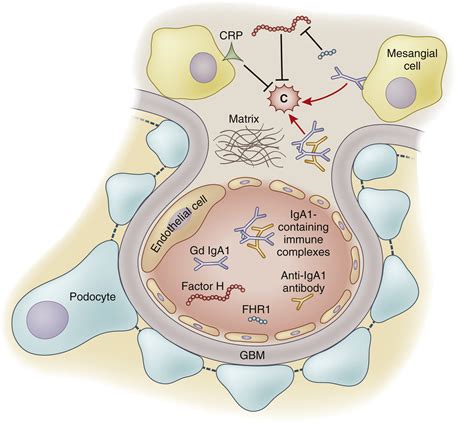 Complement Factor H Related Proteins In Iga Nephropathy—sometimes A