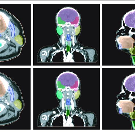 Comparison Of Han Oars Segmentation Using Eb Net Based Download Scientific Diagram