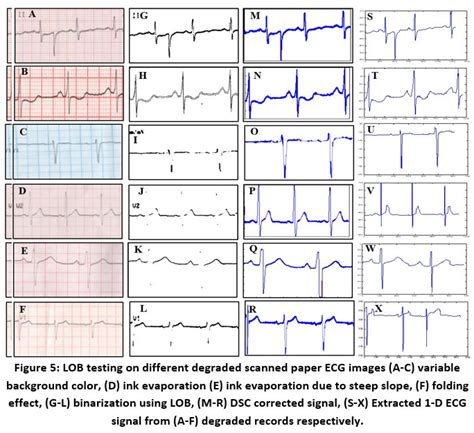 Computationally Efficient Lob Algorithm For Digitization Of Degraded