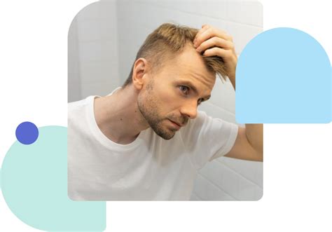 Get An Oral Minoxidil Prescription Online For Hair Loss