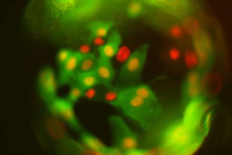 New Gene Editing Tool Helps Zero In On Small Cancer Linked Mutations