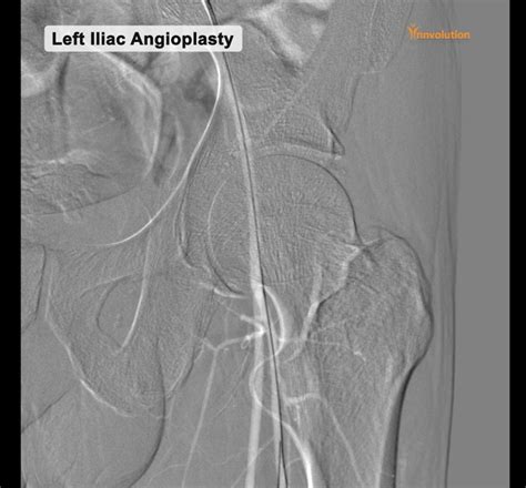 Innvolution Healthcare Private Limited On Linkedin Innvolution