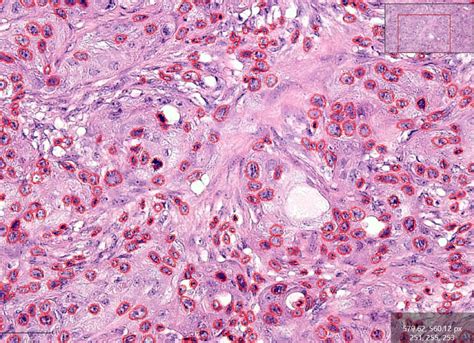 Question About Using Qupath Script To Detect Cells Image Analysis Imagesc Forum