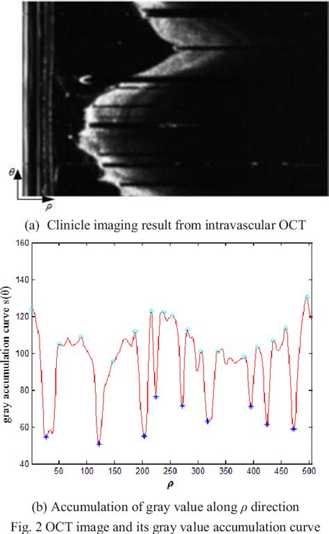 Figure 2 From An Automatic Stent Detection For Intravascular Optical