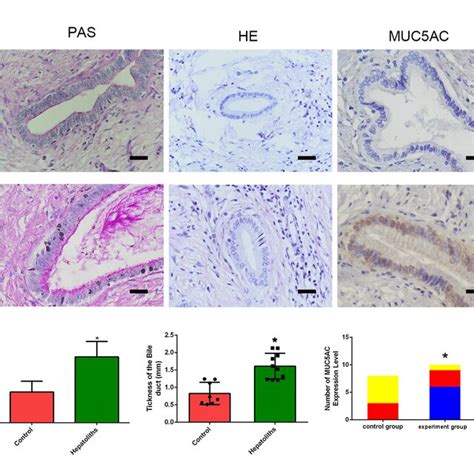 Schema Of Roux En Y Hepaticojejunostomy And Eus Guided Approach To The Download Scientific