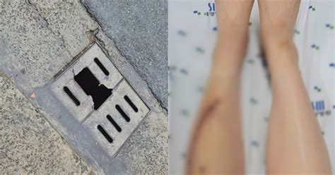 아기 안은 채 철퍼덕 깨진 하수구 밟은 여성 종아리 24바늘 꿰매