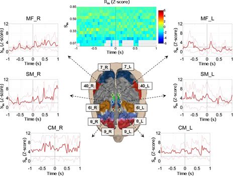 Figure 3 From Brain Network Analysis From High Resolution Eeg Recordings By The Application Of