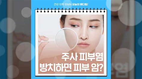 얼굴 붉어지는 주사 피부염 방치하면 피부 암 네이버 포스트