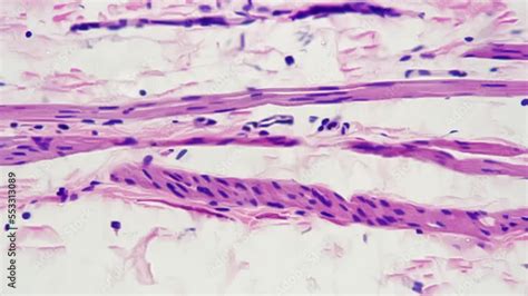 Stratified Squamous Epithelium In Section Is Filmed Under Microscope 400x On White Background