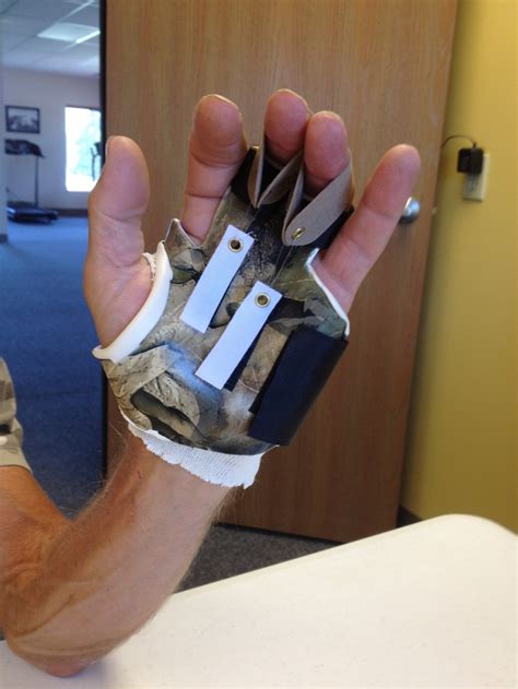 Dynamic Pip Flexion Splint For Mf And Rf Hand Therapy Occupational