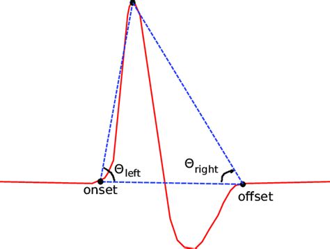 Features Related To Slopes Based On Onset Offset And Peak Points Download Scientific Diagram