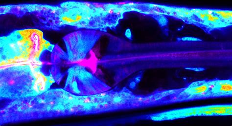 Bacteriophages And Their Relationship With Crispr Cas And Other Defense Systems In Bacteria