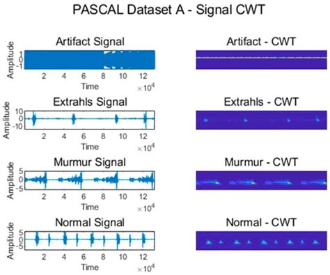 Applied Sciences Free Full Text Heart Sound Classification Using
