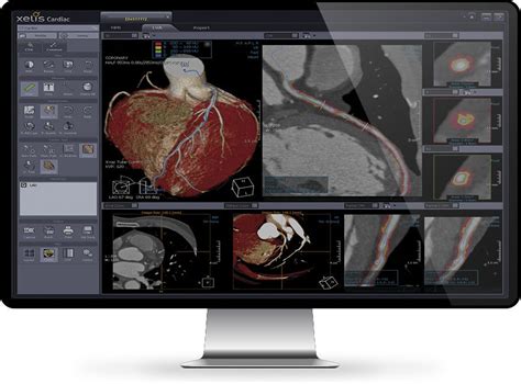 Analysis Software Xelis™ Cardiac Infinitt North America 3d