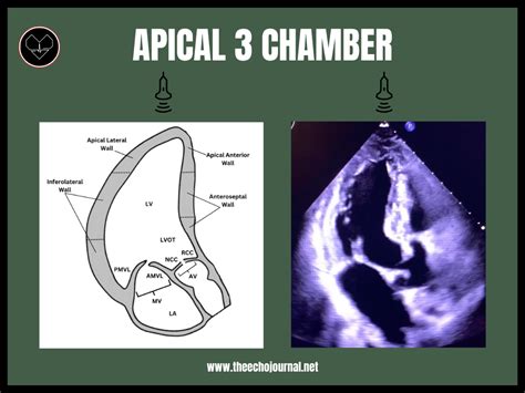 Apical 2 And 3 Acquisition Angles And Accuracy