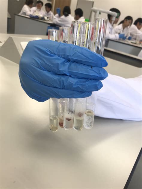 Liver Enzyme Lab Natakorn