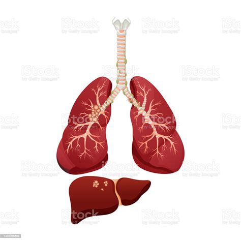 다이어그램 폐암 질환 개념 질병 인간의 내부 장기 벡터 일러스트 레이 션 만화 스타일 간 내부 기관에 대한 스톡 벡터 아트 및 기타 이미지 Istock