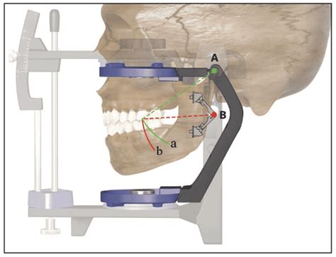 The Abcs Of Occlusion And Articulation Reducing Positive Errors For Fewer Adjustments