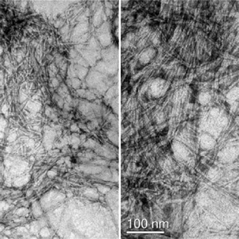 Pdf The Role Of Cellulose Nanofibrils In Structure Formation Of