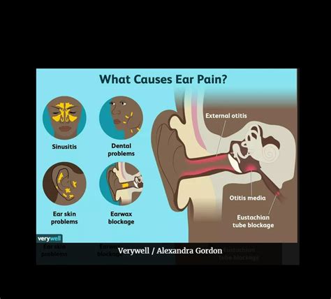 Toothache And Ear Pain In The Same Side Symptoms Off