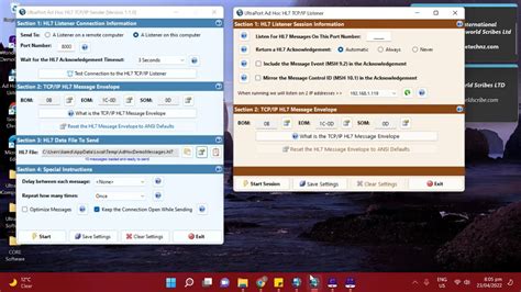 Free Hl7 Tcpip Listener Youtube