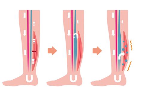 Отоци по краката през лятото For Life