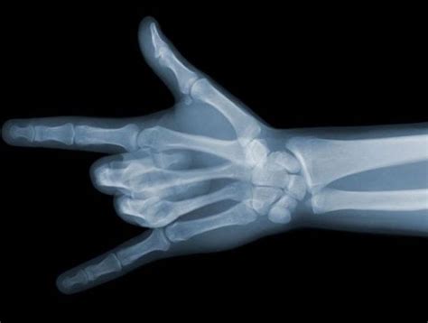 X Ray By Nick Veasey Art