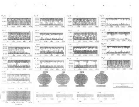 Figure 2 From Implementation Of Labview Based Vibration Monitoring System For Turbine Generator