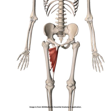 Groinadductor Strain