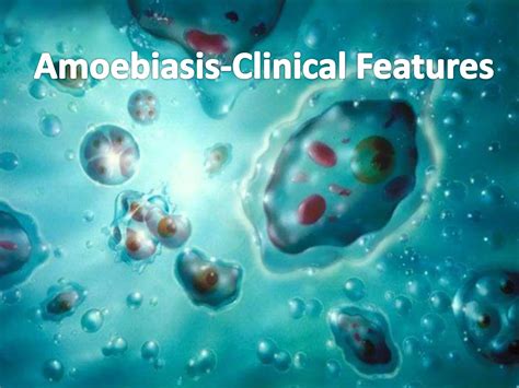 Amoebiasis Clinical Features Pptx