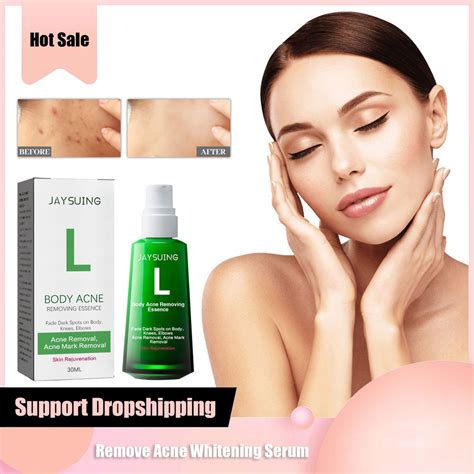 Acne Remover Face Serum Herbs Acne Treatment Pimple Remover Shrink Pores Oil Control Face Herb