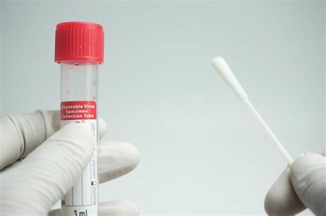 Premium Photo Holding Disposable Virus Specimen Collection Tube Take Samples For Virus Checking