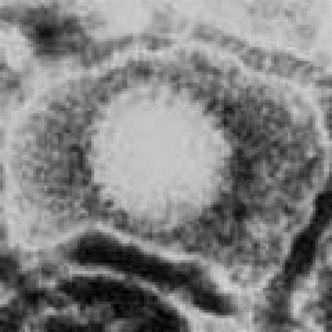 Center For Infectious Disease Dynamics The Huck Institutes En Us