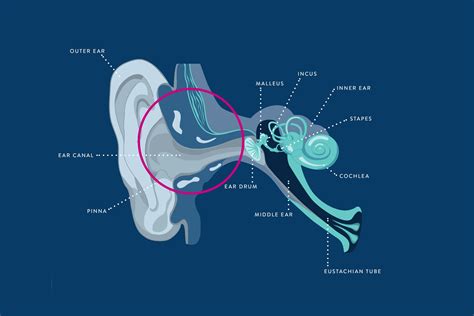 Conductive Hearing Loss Signs Causes And Treatment Thcp
