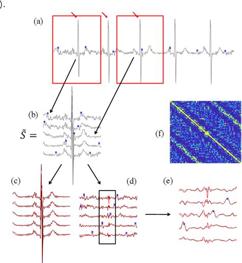 Figure 1 From Adaptive Optimal Shrinkage Of Singular Values Under