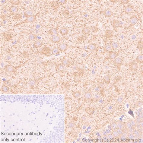 Anti Map2 Antibody [epr19691] Neuronal Marker Chicken Igy Chimeric