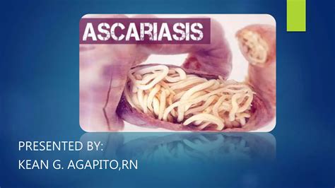 Ascariasis Ppt